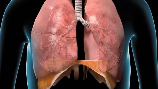 Fibrose pulmonaire progressive : intérêt du nintedanib en vraie vie